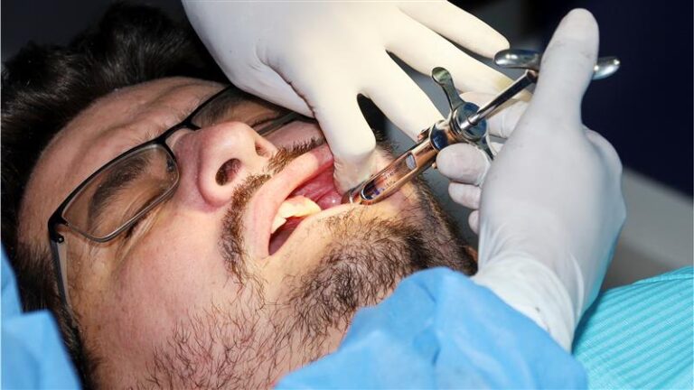 Post-operative Instructions for Wisdom Teeth Removal